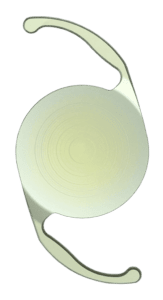 PanOptix® Lenses: Trifocal Lens Implant | Cleveland Eye Clinic