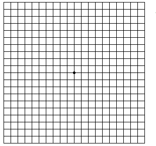 Amsler Grid Test | What Does Amsler Grid Test For